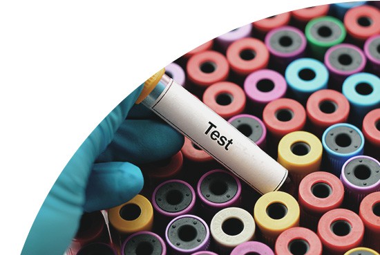 Sexual Health Screening Services London Travel Clinic